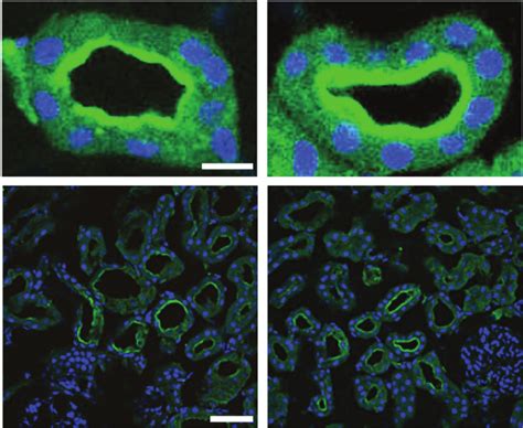 Expression Of Napi Iia In The Proximal Tubule Without And With Download Scientific Diagram