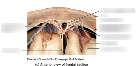 Protective Coverings Of The Brain Diagram Quizlet