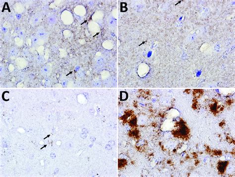 Immunohistochemical Analyses Of Disease Associated Prion Protein Prp