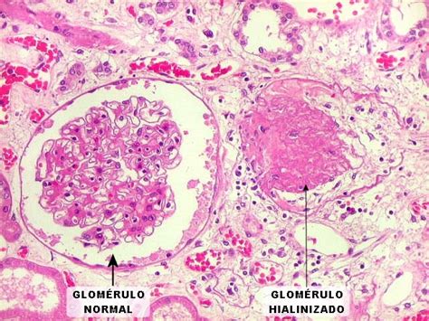 Glomerulo Histologia Renal Glomerulus Anatomy Structure And