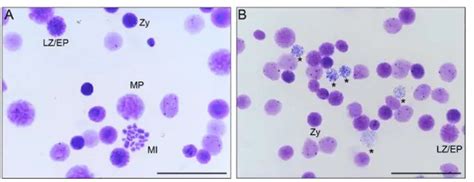 Prophase Definition Staining Steps Importance Biology Notes Online