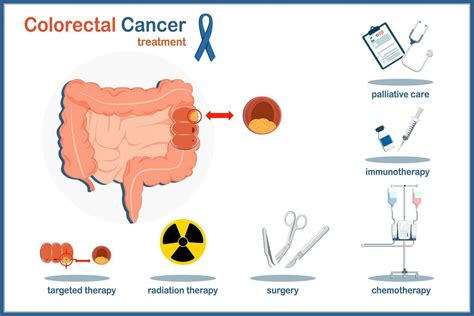 médico vector ilustración concepto. humano colon y colon cáncer. tratos de colorrectal cáncer ...