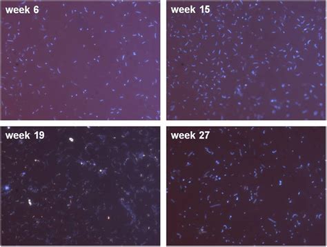 Microscopic Examination 1000 Fold Magnification Of Dapi Stained Cells Download Scientific