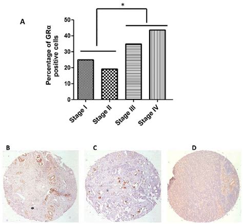 Protein Expression Of Grα Using Tissue Microarray Positive Staining Download Scientific