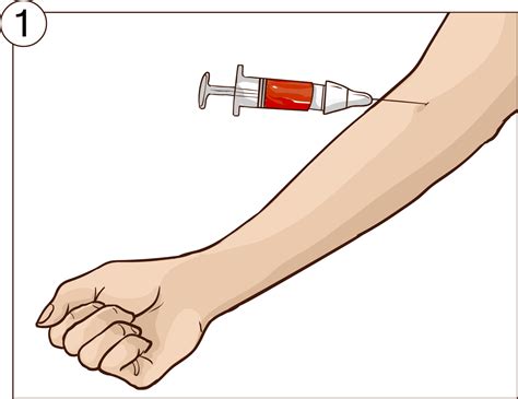 Joint Injection Therapy In Warrenville Il Peak Health Institute