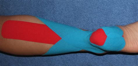 Achilles Tendon Taping Technique Ljprrc
