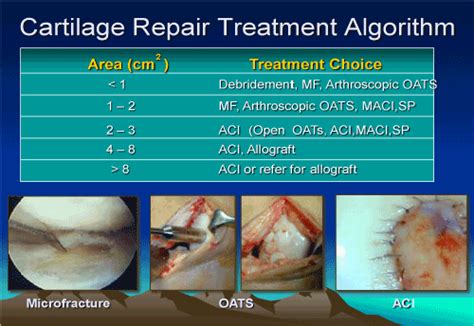 Cartilage Damage A Review Of Surgical Repair Options And Outcomes Cartilage Damage A Review Of Surgical Repair Options And Outcomes