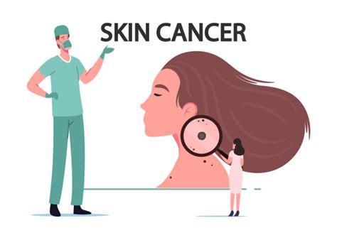 Mole Skin Illustrations Royalty Free Vector Graphics And Clip Art Istock