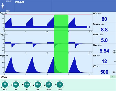 Ventilation Modes Neuroresus