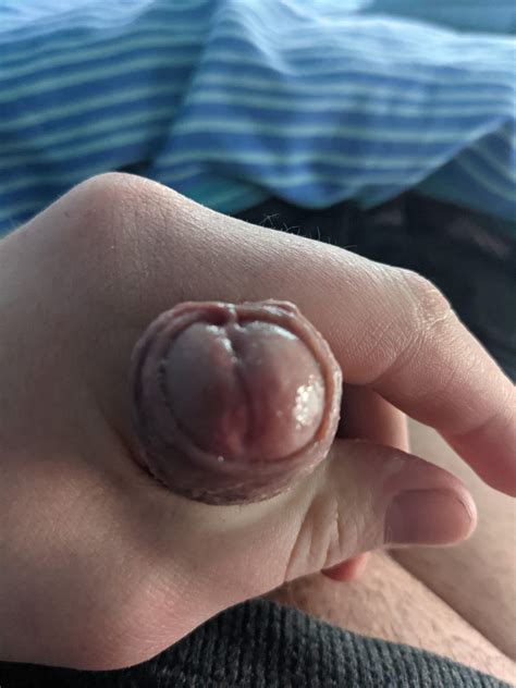 The Tip R Phimosisappreciation