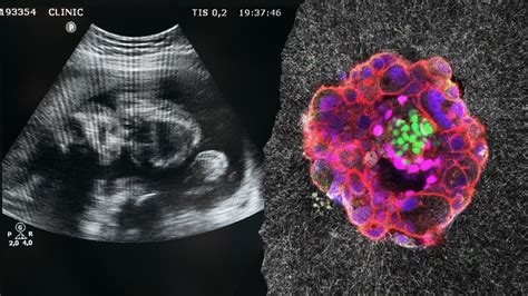 Watch The Exact Moment A Human Embryo Implants In Real Time