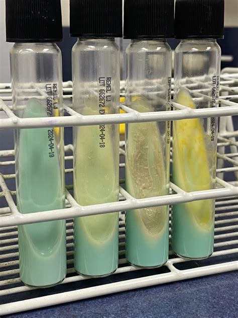 Medio De Cultivo Lowenstein Jensen Una Herramienta Esencial Para El Diagnóstico De La