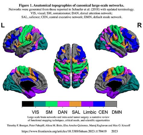 large scale brain network wikiwand
