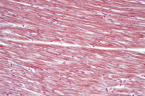 Human Cardiac Muscle Light Micrograph Healthy Organ Stock Photo