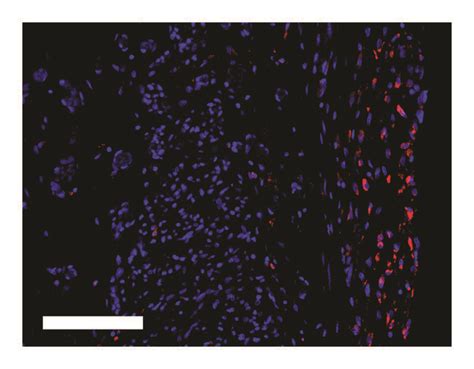 Photomicrographs Illustrating The Optical Density Of The Connective Download Scientific Diagram