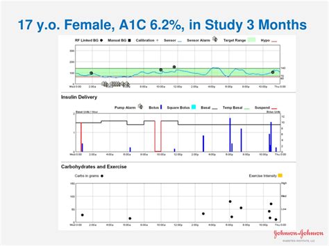 PPT Continuous Glucose Monitoring PowerPoint Presentation Free Download ID 1526224