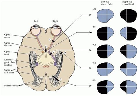 Lateral Geniculate Visual Field