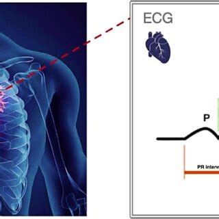 ECG Signal Adapted From Download Scientific Diagram