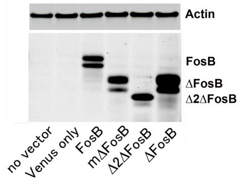 Functional Role Of The N Terminal Domain Of Δfosb In Response To Stress