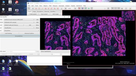 No Reaction With Qupath Pixel Classifier Image Analysis Imagesc Forum