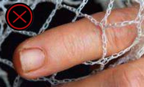 Sydney Wildlife Rescue Safe Netting Of Your Fruit Trees