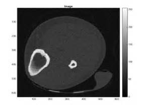 Matlab Detecting And Isolating Part Of An Image Signal Processing Stack Exchange