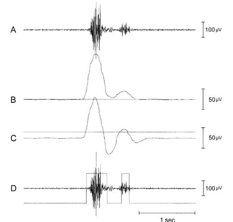 A D Representation Of The Emg Analysis Procedure A Raw