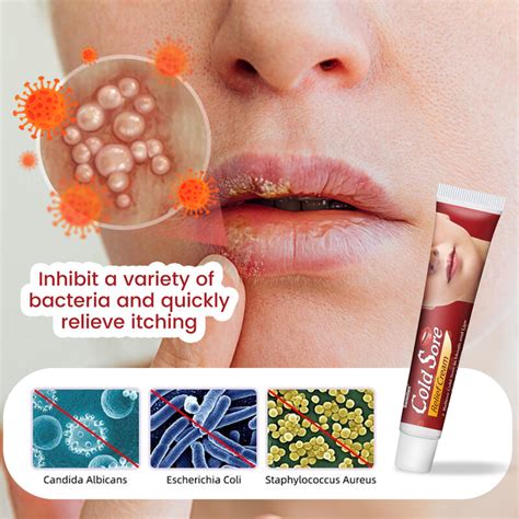 20g Cold Sores Lip Care Cream Repair Cheilitis Lips Herpes Ulceration