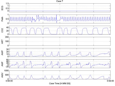 Case 7 Waveform Plots 60 Second Plots
