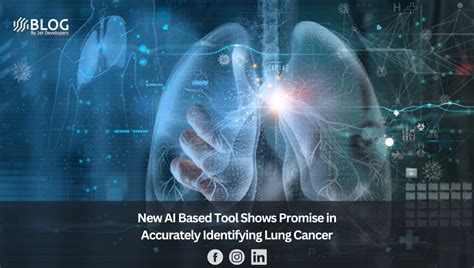 New Ai Based Tool Shows Promise In Accurately Identifying Lung Cancer