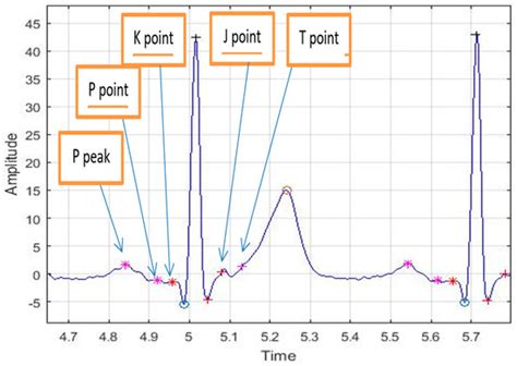 Significance Of Features From Biomedical Signals In Heart Health Monitoring