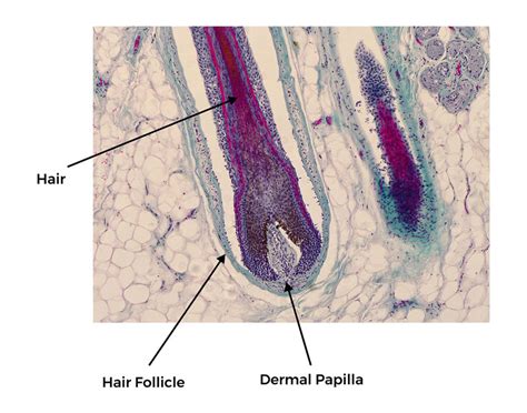 The Common Cause Of Hair Loss Tricotain Hair Retaining Shampoo