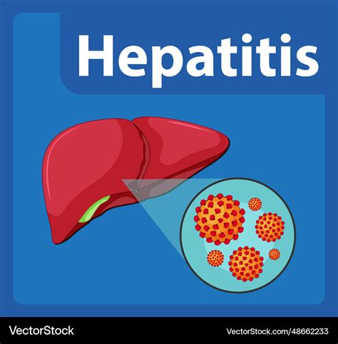Close Up Of Hepatitis Virus Cell On Human Liver Vector Image