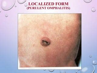Intrauterine Infection In A Pregnant Women Ppt