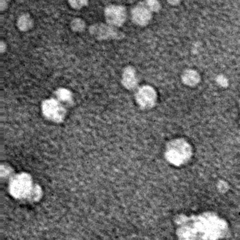 Polystyrene Beads Instance Segmentation Dataset By Zivkoviclab