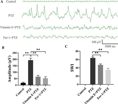 EEG Recordings Of Each Group Of Rats A Representative Traces Of EEG In Download Scientific