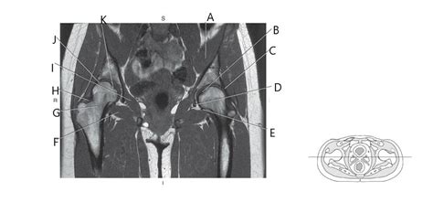 Week 14 Assignment 2 Q1 Diagram Quizlet