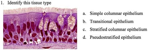solved 1 identify this tissue type simple columnar epithelium b