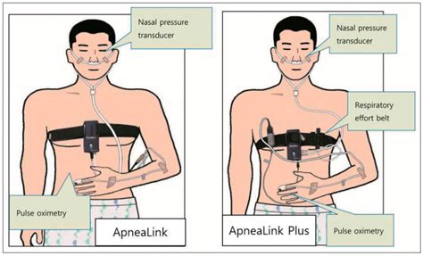A Novel Human Respiration Pattern Recognition Using Signals Of Ultra