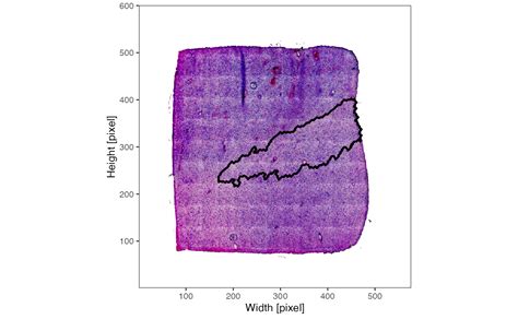 Creating Spatial Annotations • Spata2
