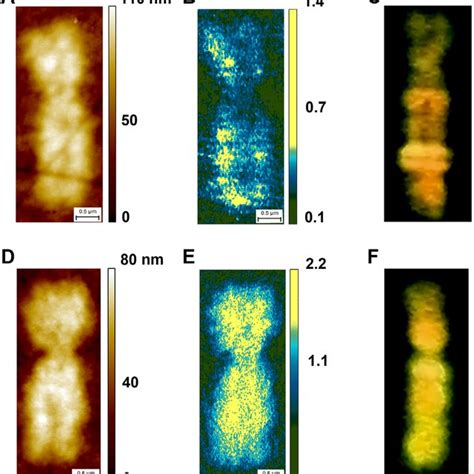 AFM IR On Xs Female Chromosomes A And D AFM Topography Of Active X Download Scientific