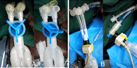 The Clinical Application Of Yrc A And Yc B Download Scientific Diagram