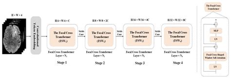 Frontiers Focal Cross Transformer Multi View Brain Tumor