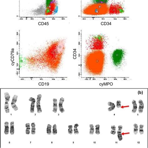 A Immunophenotyping Of The Patients Bone Marrow Specimen At Initial Download Scientific