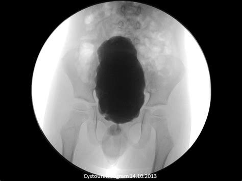 Concluding With Radiological Images Dr Tejas Ghoorah Mbbs Md Concluding With Radiological Images Dr Tejas Ghoorah Mbbs Md