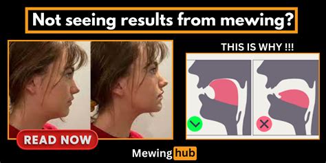 5 Reasons Why You Are Not Seeing Mewing Results Mewinghub