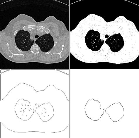 A Generic Boundary Extraction Process Top Left To Righta Original Download Scientific