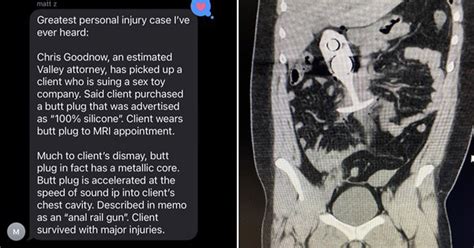 Person Impaled By Butt Plug While Wearing It During An Mri Suing Maker