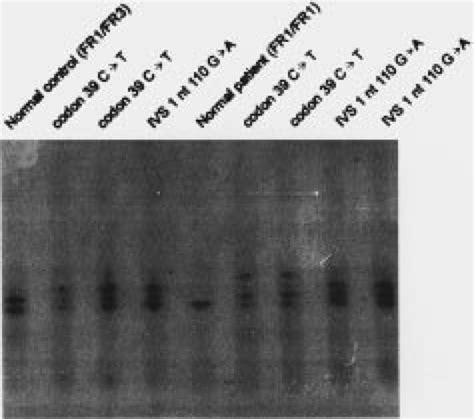 Detection By Dgge Analysis Of Fragment C Ofof Taq Dna Polymerase