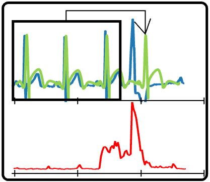 Forecasting Based Methods TSB UAD Documentation